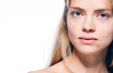Uneven Skin Tone & Dull Skin - Biogenesis Aesthetic Clinic